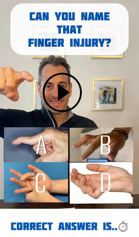 The 5 Most Common Finger Deformities Explained | New Path Chiropractic